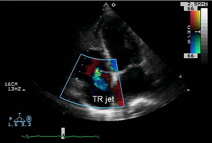 Apicals | Echocardiographer.org